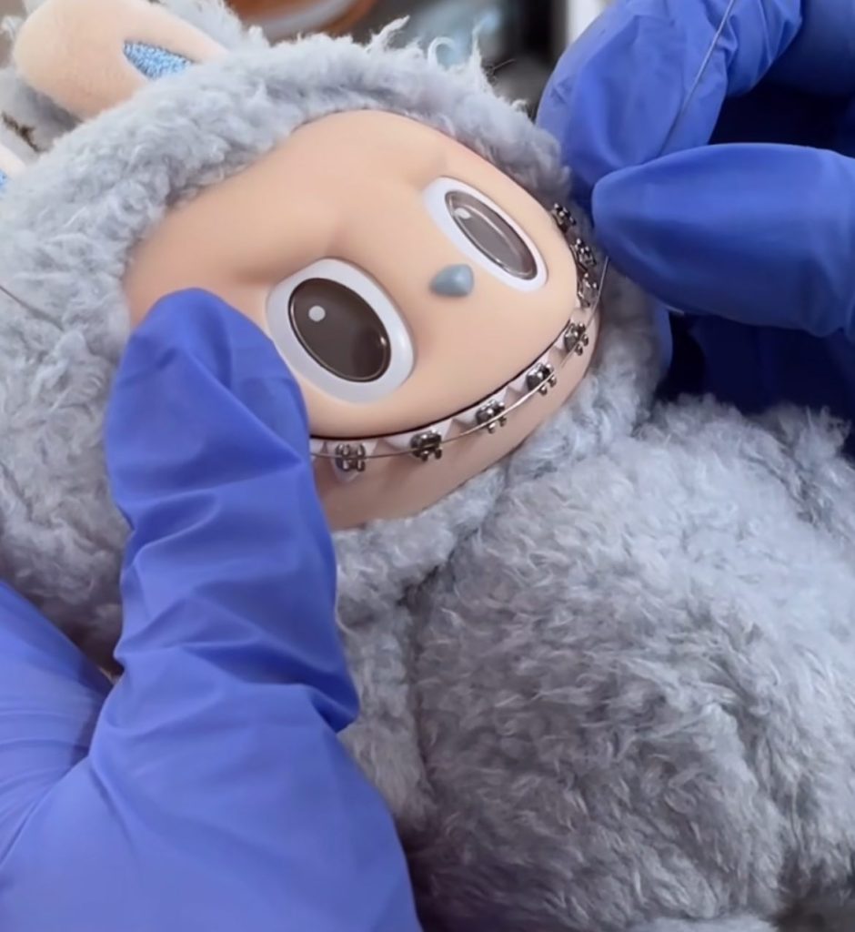 THIS DENTAL CLINIC IN SINGAPORE INSTALLS ACTUAL BRACES FOR YOUR LABUBU ...